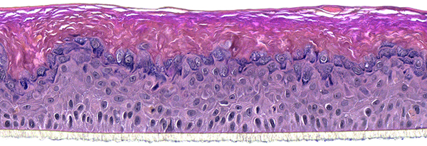 SkinEthic RHE Reconstructed Human Epidermis