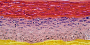EpiSkin epidermal model